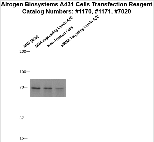 A431 Transfection Reagent (Epidermoid Carcinoma) | Transfection ...