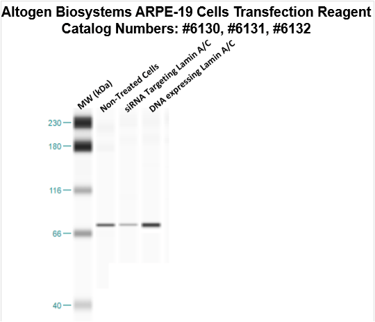 ARPE-19 Transfection Kit (Retinal Pigment Epithelium) | Transfection ...