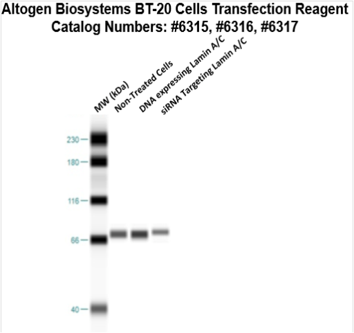 BT-20 Transfection Reagent (Breast Carcinoma Cells) | Transfection ...