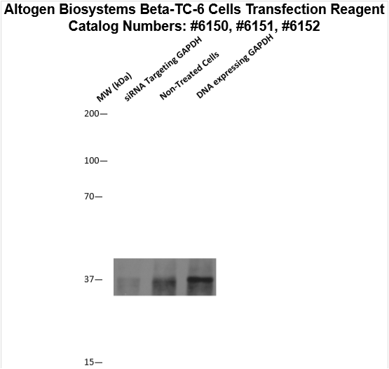 Beta-TC6 Transfection Kit (Pancreas, CRL-11506) | Transfection Reagents ...