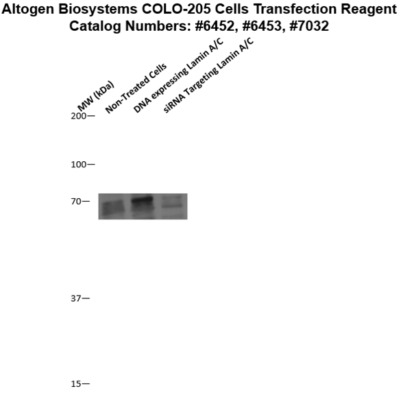 COLO205 Transfection Reagent (Colon Carcinoma) | Transfection Reagents ...