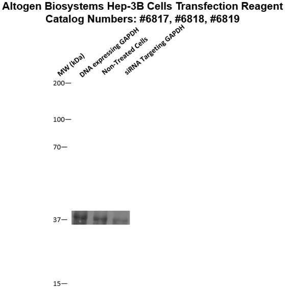 Hep-3B Transfection Kit (Hepatocellular Carcinoma) | Transfection ...