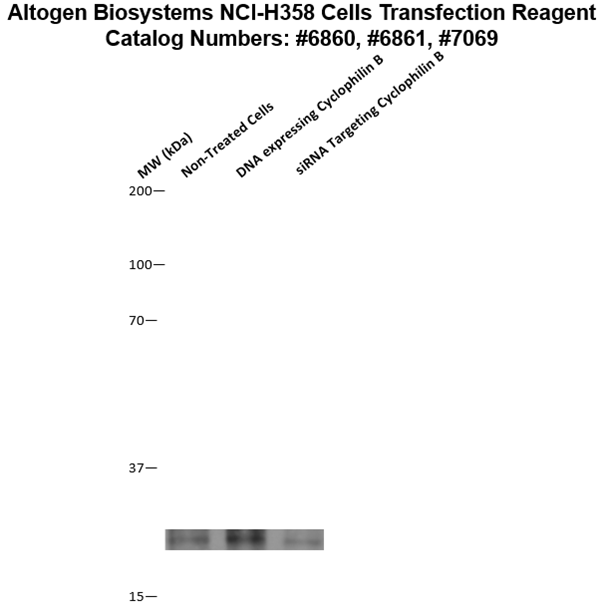 NCI-H358 Transfection Kit (Bronchioalveolar Cells) | Transfection ...