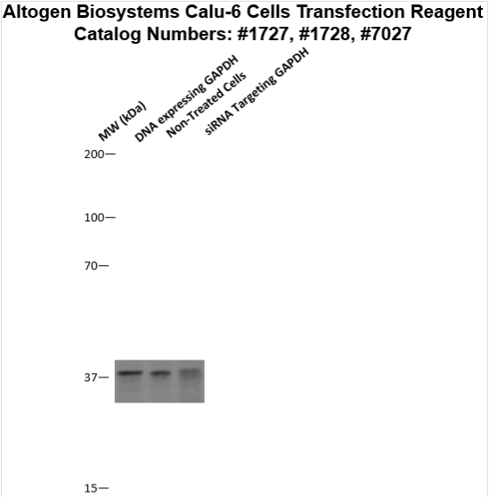 Calu-6 Transfection Kit (Lung Carcinoma, HTB-56) | Transfection ...